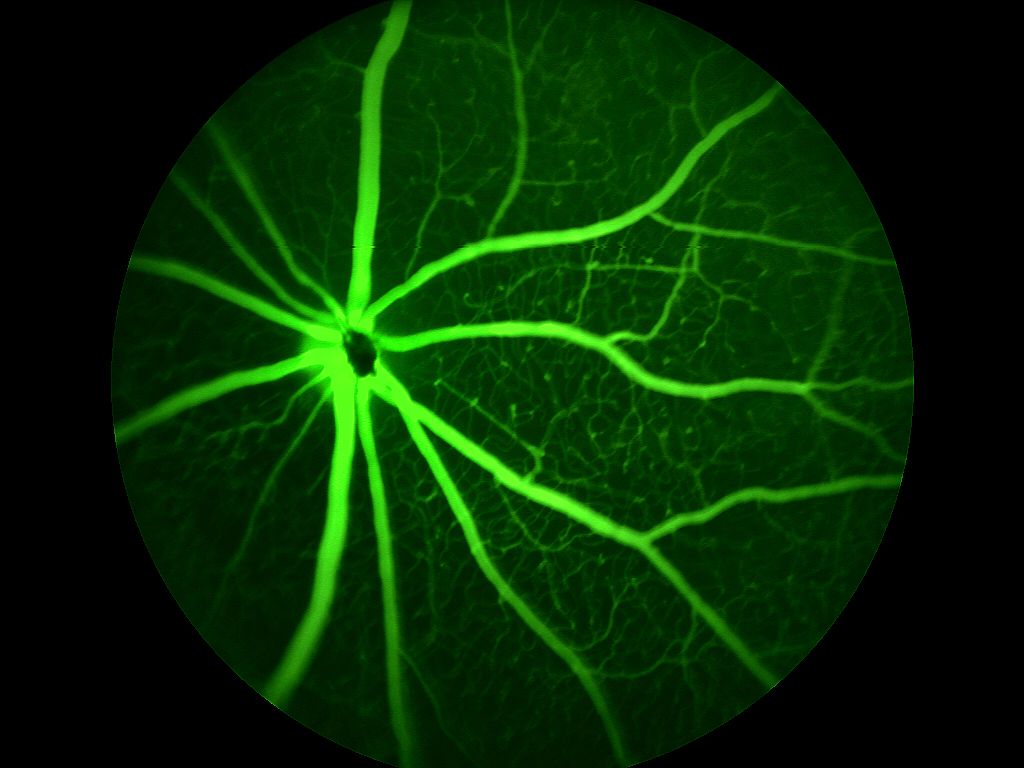Bond researchers' quest to cure blindness | Bond University | Gold ...