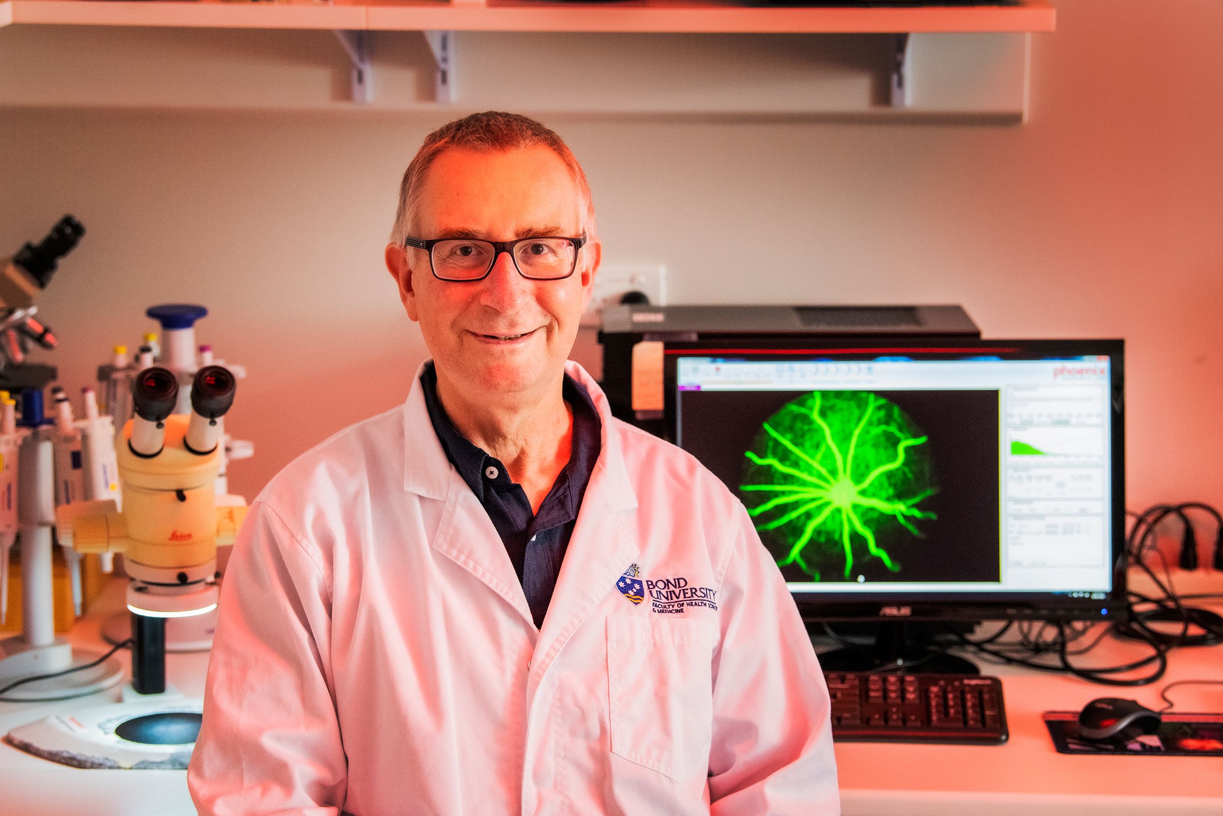 Bond researchers' quest to cure blindness | Bond University | Gold Coast, Queensland, Australia