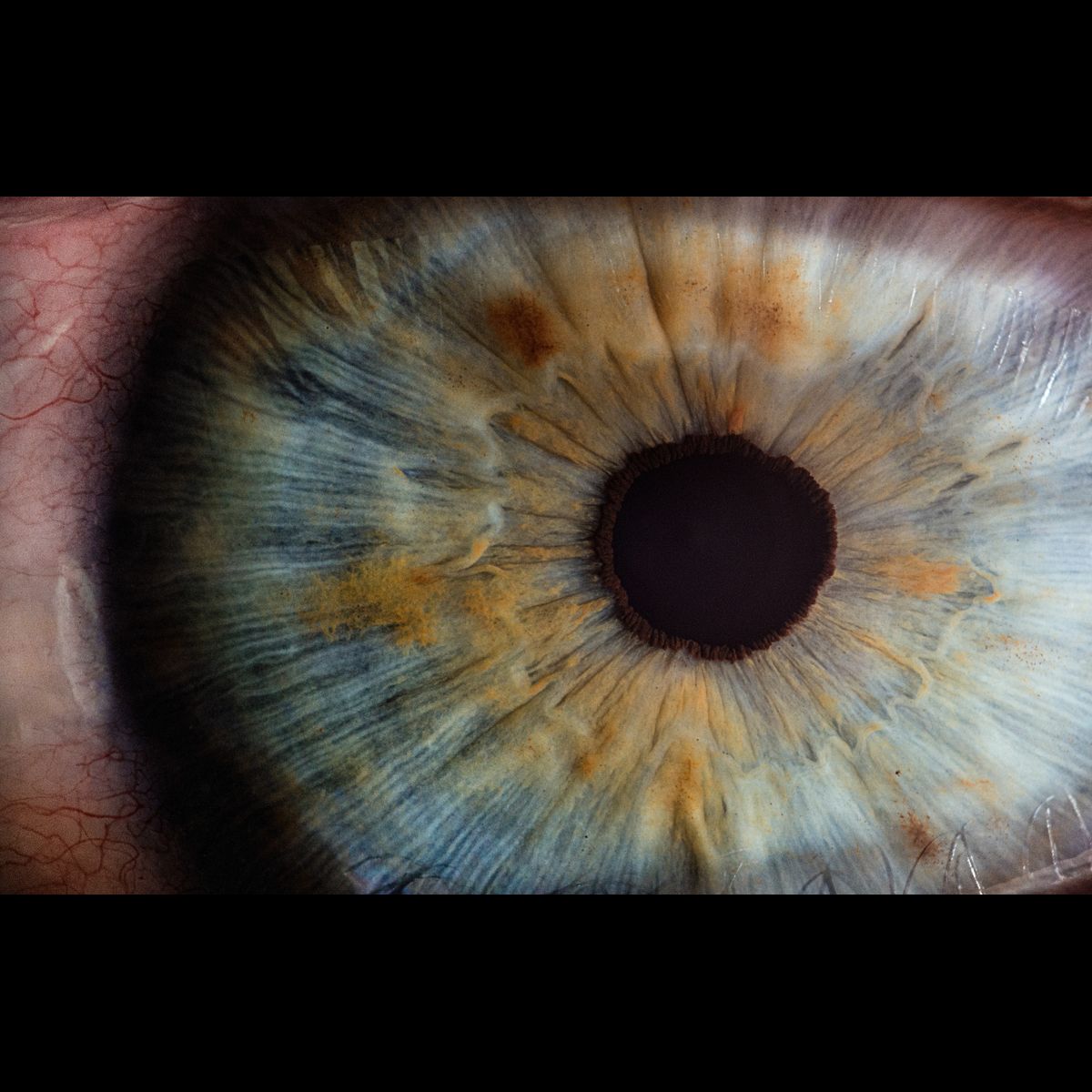 The science of eye colour explained | Bond University | Gold Coast ...
